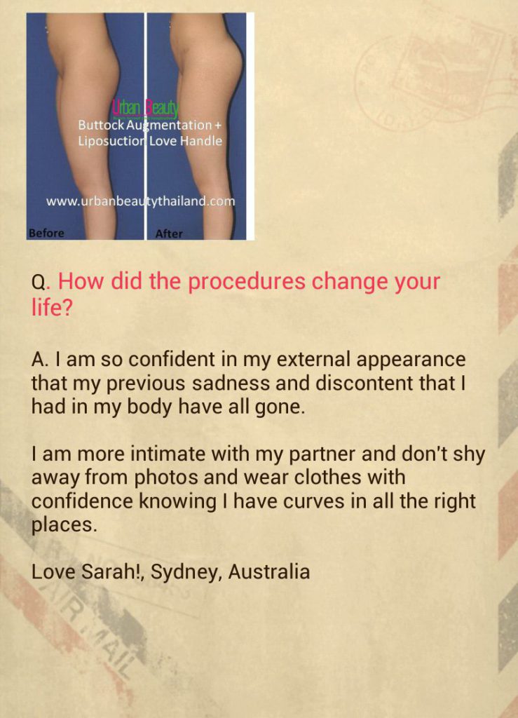 Buttock Augmentation - Urban Beauty Thailand